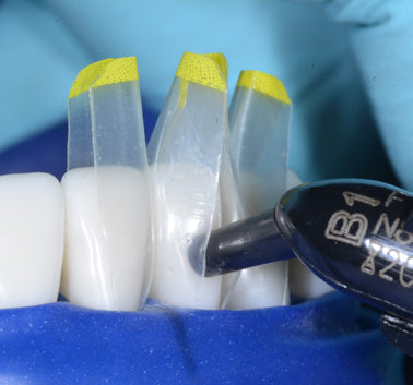 Bioclear Method – Bioclear UK