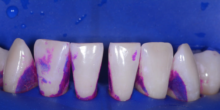 Bioclear Method – Bioclear UK