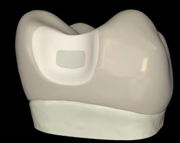 Bioclear Method – Bioclear Matrix UK