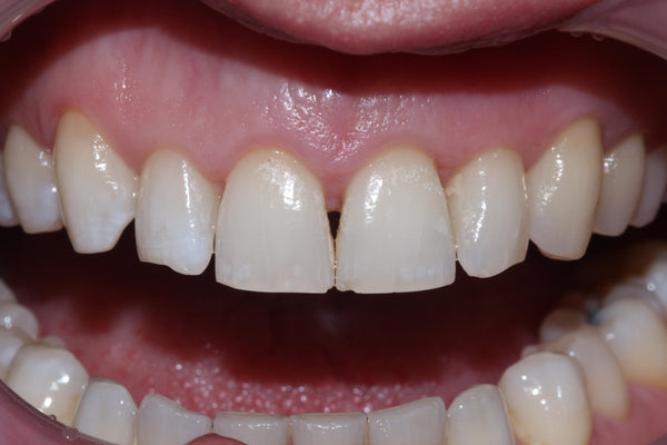 Introduction to Bioclear for Composites Course Birmingham Friday 27th ...